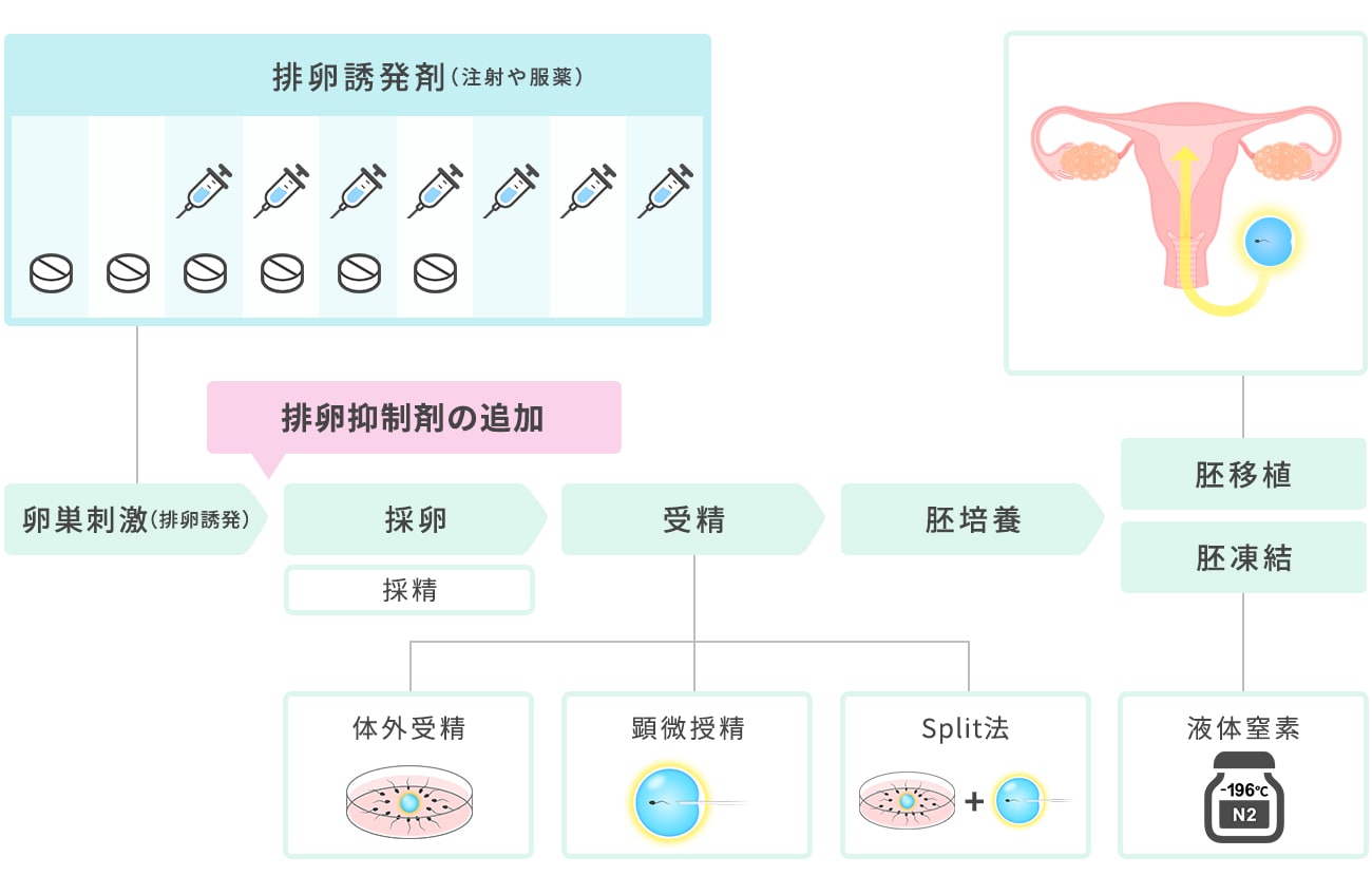 高度生殖補助医療(体外受精) 治療について 【不妊治療専門】第二協立病院artセンター
